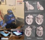 O Futuro da Engenharia Médica com Living Heart